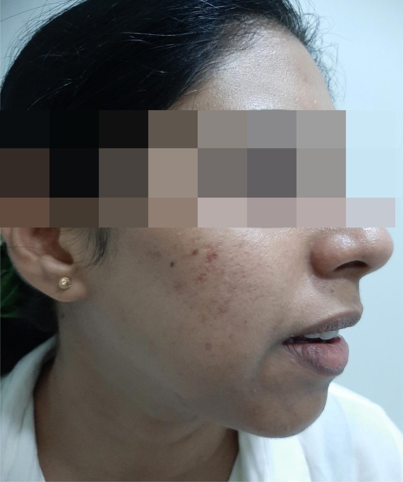 Tender Skin International | Leading Skincare Clinic in Mumbai, Pune & Dubai